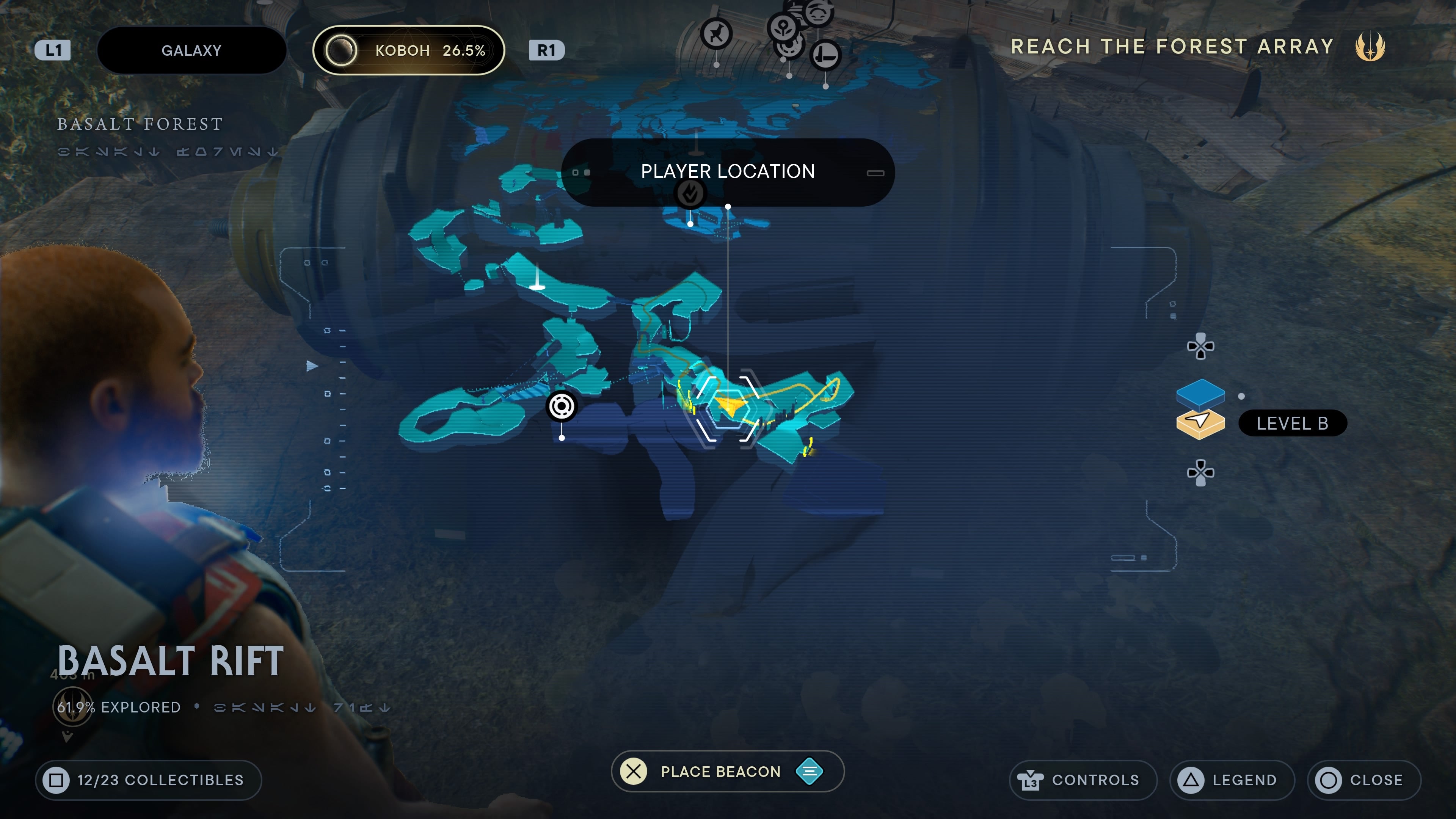 All Health Stim Upgrades in Star Wars Jedi: Survivor | VG247