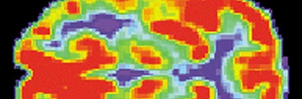 Multiplayer Brainscans | Rock Paper Shotgun